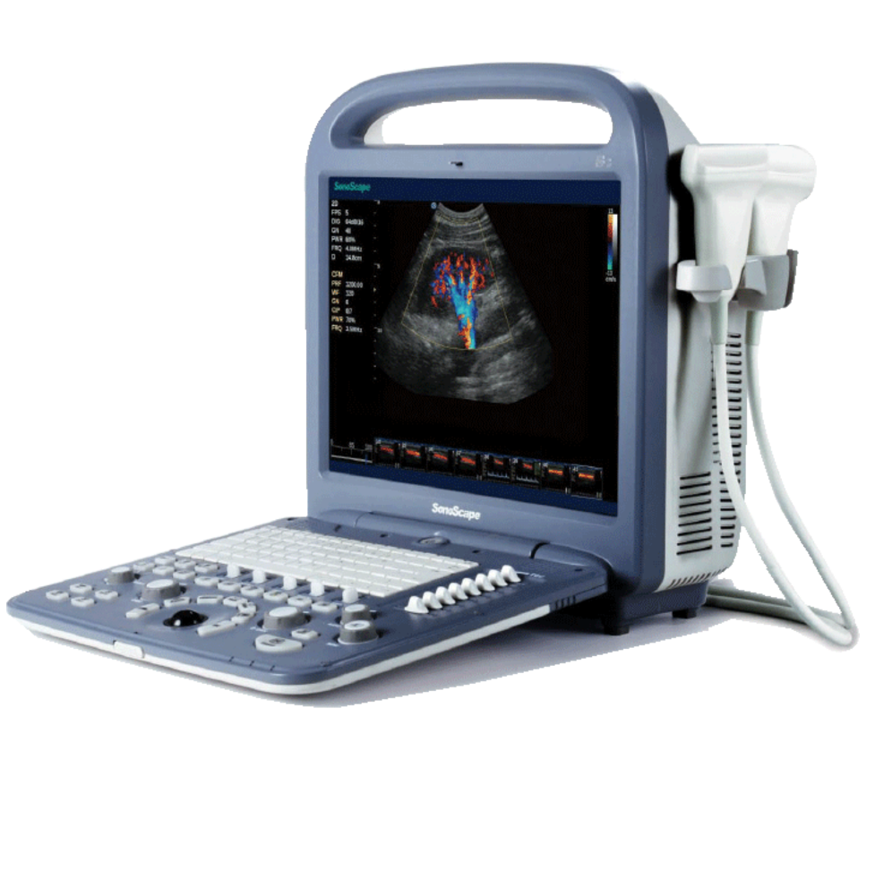 SonoScape S2V Ultrasound-Portable Color Doppler, Practical, Affordable ...