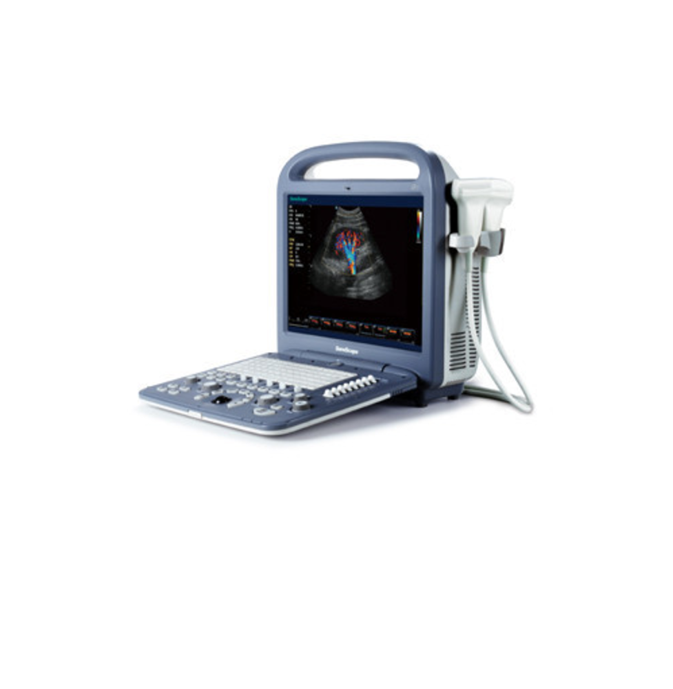 Used SonoScape S2V Ultrasound | User Friendly Affordable Color Doppler ...